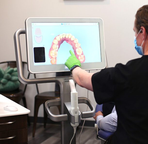 iTero® Intraoral Scanner & Outcome Simulator | Shine Orthodontics